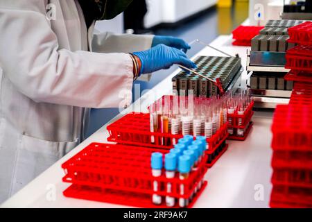 Technical platform of the Inovie 34 laboratory . Hematology tube sorter. NFS, blood count, VS ...