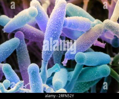 Scanning Electron Micrograph (SEM) of Microsporum gyseum. Microsporum ...