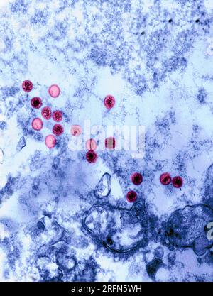 Transmission Electron Micrograph (TEM) revealing the presence of ...