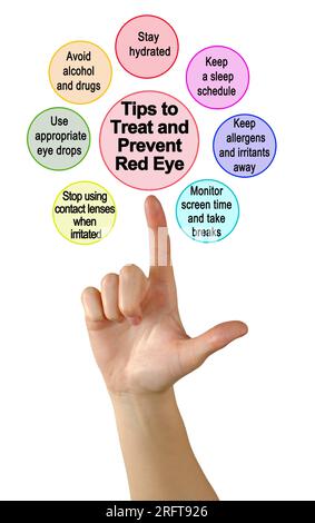 Tips to Treat and Prevent Red Eye Stock Photo - Alamy