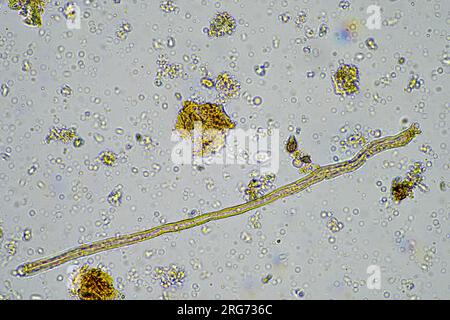plant cellulose in a soil sample under the microscope on a farm Stock ...