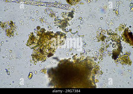 plant cellulose in a soil sample under the microscope on a farm Stock ...