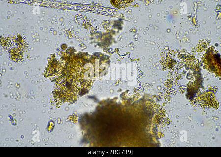 plant cellulose in a soil sample under the microscope on a farm Stock ...