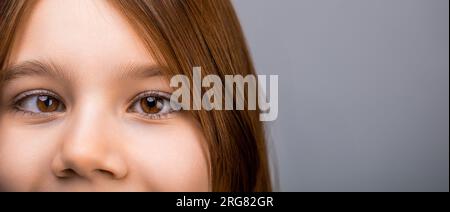 Strabismus in children causes, treatment concept. Female eyes with ...