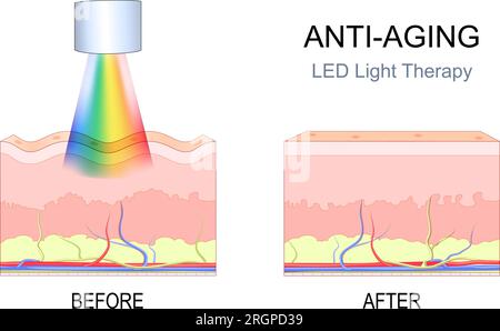 Young and aging skin cross section diagram Stock Vector Image & Art - Alamy