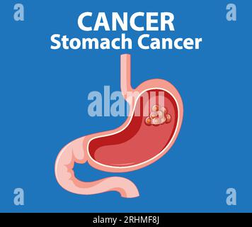 Detailed cartoon-style illustration depicting the anatomy of stomach ...