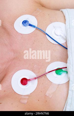Holter monitoring equipment on chest of patient, Health care and ...