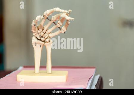 This life size, articulated human hand skeleton model is a great tool ...