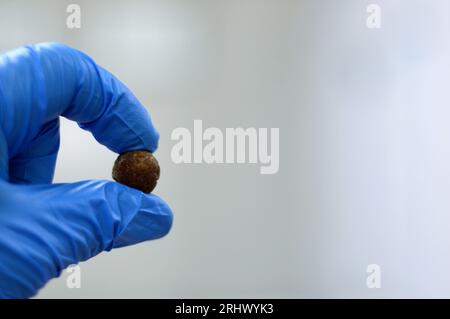 Large gallstone removed surgically after laparoscopic cholecystectomy ...
