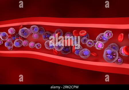Multiple myeloma (MM) cells in the blood flow - microscopic view 3d ...