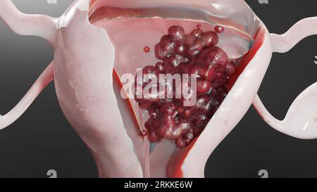 female reproductive system anatomy 3d illustration Stock Photo - Alamy