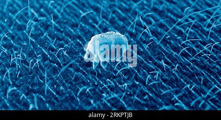 Scabies mite on human skin, illustration Stock Photo - Alamy