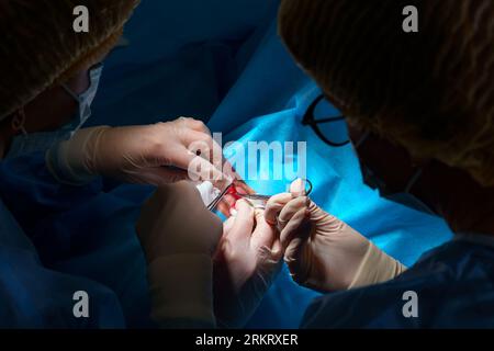 Rejuvenation and modification of the area around the eyes Stock Photo ...