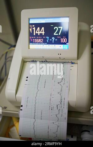 Cardiotocograph recording fetal heart rate and uterine contractions ...
