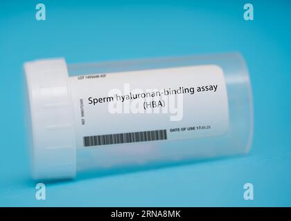 Sperm hyaluronan-binding assay Stock Photo - Alamy