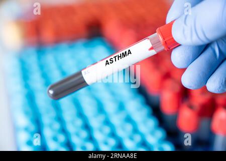 Asthma. Asthma disease blood test in doctor hand Stock Photo - Alamy