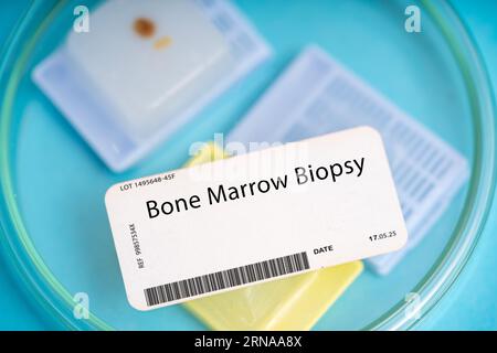 Bone Marrow Biopsy Sample