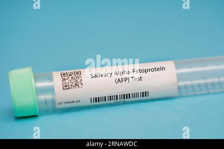 Salivary alpha-fetoprotein test Stock Photo - Alamy