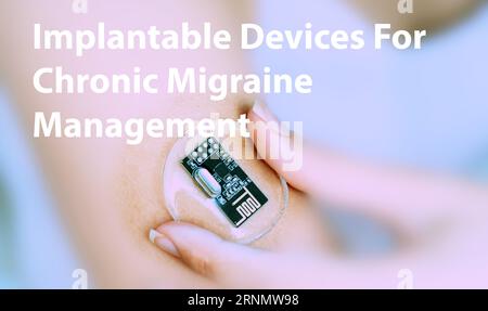 Implantable neurostimulation for migraines: Devices that provide ...