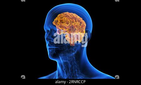 Degenerated human brain, illustration Stock Photo - Alamy