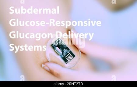 Implantable glucose-responsive glucagon delivery systems: Devices that ...