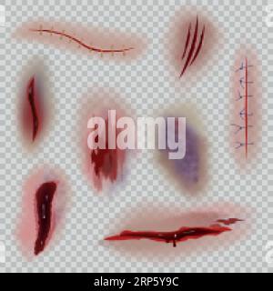 Bloody wounds. Scars, surgical stitches and bruis, skin cuts. Bloody ...