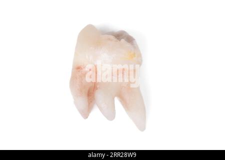 Pulled wisdom tooth, tooth, carious, damaged, white background Stock ...
