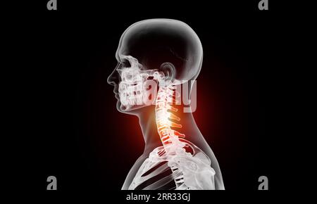 Side view of cervical section of spine x-ray render on black background ...
