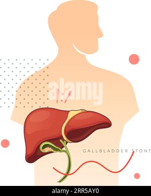 Gall Bladder Icon Stock Illustration as EPS 10 File Stock Vector Image ...