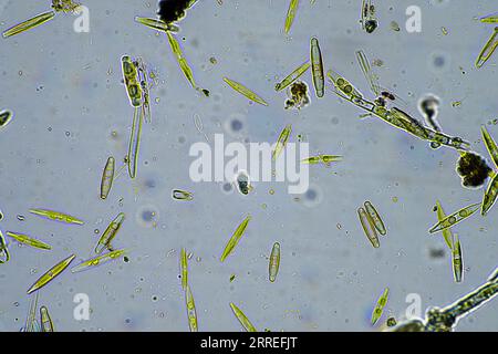 diatom and water microorganisms under the microscope in australia Stock ...