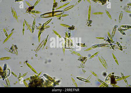 diatom and water microorganisms under the microscope in australia Stock ...