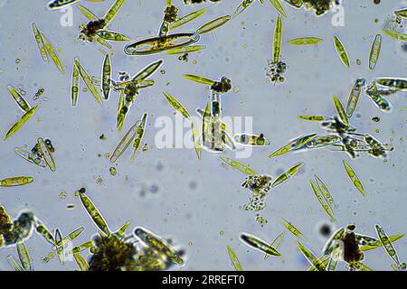 diatom and water microorganisms under the microscope in australia Stock ...