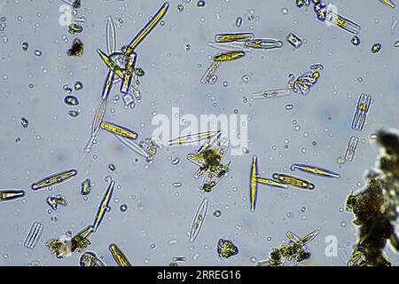diatom and water microorganisms under the microscope in australia Stock ...