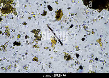 soil microorganisms close up under the microscope. in a soil samlple ...
