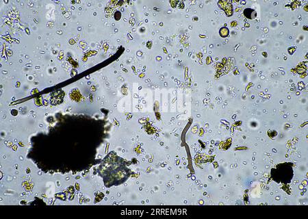 soil microorganisms close up under the microscope. in a soil samlple ...