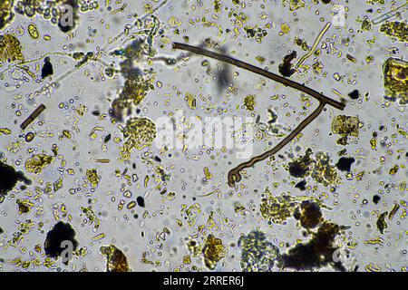 soil life under the microscope with soil fungi and fungal hyphae on a ...