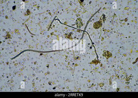 fungal hyphae and soil fungi in a soil sample, showing the living soil ...