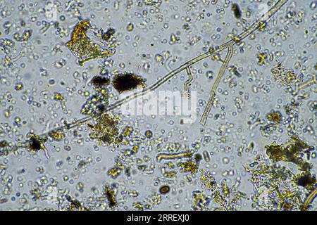 fungal hyphae and soil fungi in a soil sample, showing the living soil ...
