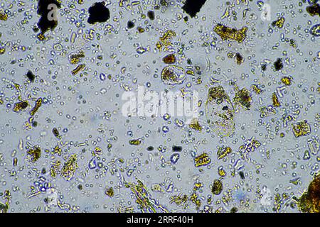 soil microorganisms close up under the microscope. in a soil samlple ...