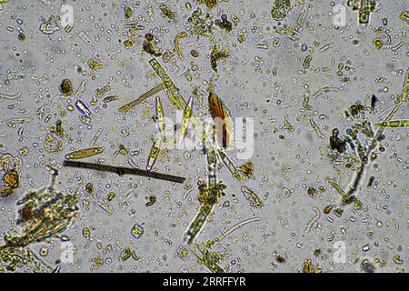 diatom and water microorganisms under the microscope in australia Stock ...