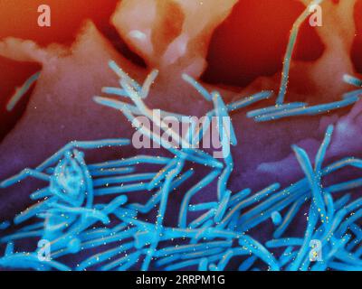 RSV, respiratory syncytial virus, human orthopneumovirus, contagious ...
