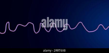 Ventricular fibrillation (VF Stock Photo - Alamy