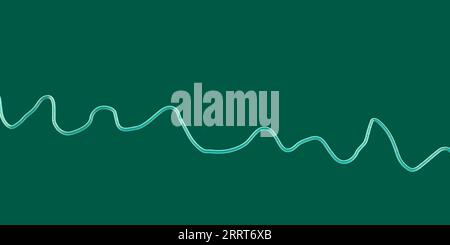 Ventricular fibrillation (VF Stock Photo - Alamy