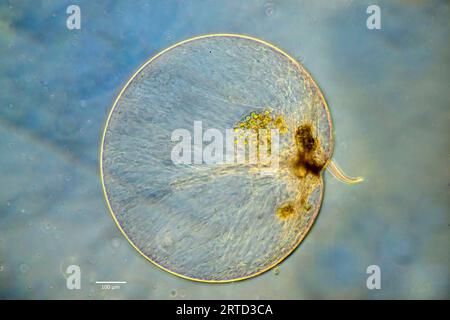The bioluminescent dinoflagellates Noctiluca scintillans sampled from ...