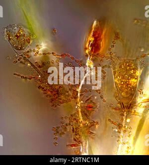 The image presentstwo suctorians ( a kind of ciliate) and tiny diatoms ...