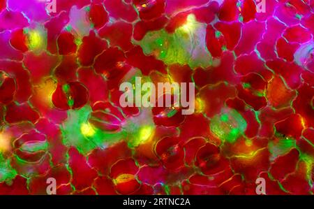 The image presents stomata in Croton leaf epidermis, photographed ...