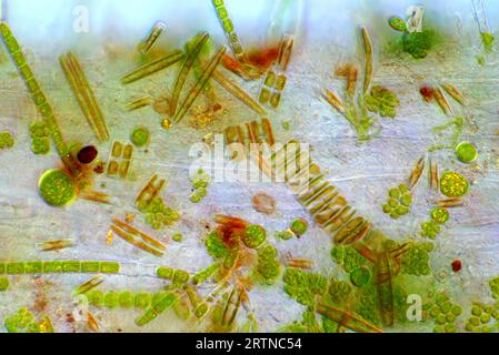 The image presents various tiny algae settled on Lemna sp. root ...