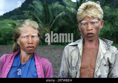 Albino people in Sumbawa, Indonesia, Asia Stock Photo - Alamy