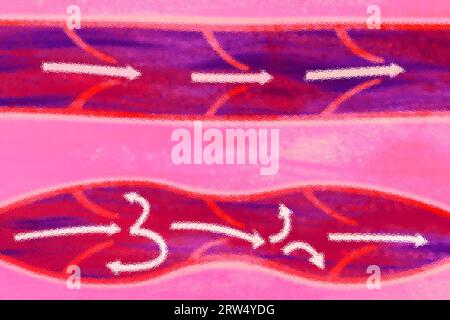 Weakness of the venous valves or an insufficiently activated muscle ...