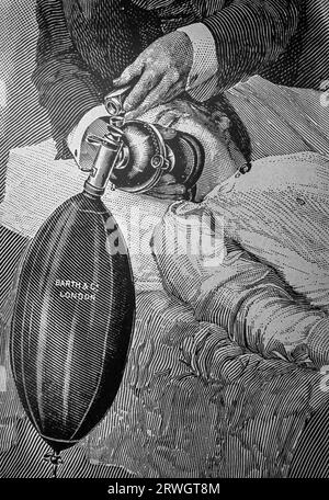 Apparatus for the administration of laughing gas (nitrous oxide ...